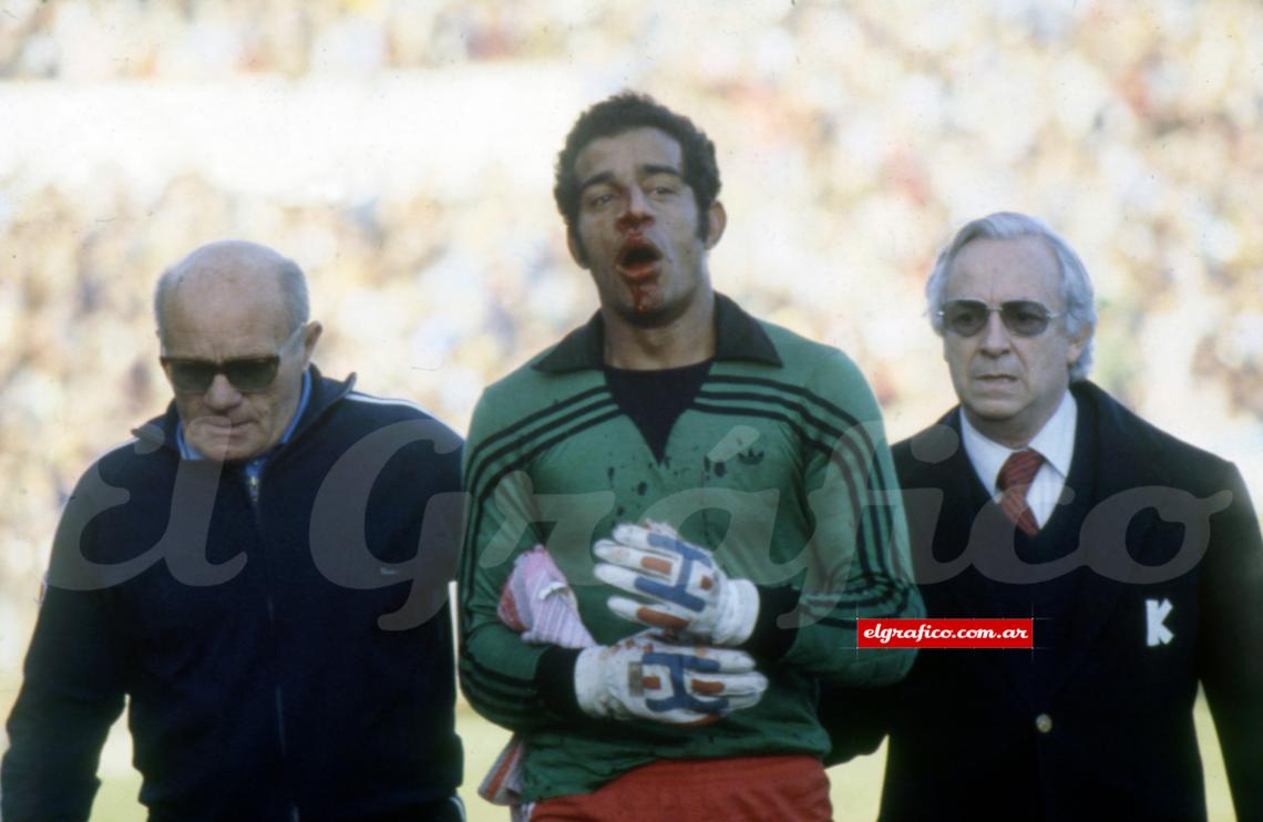 1980. El clásico se tiñe de sangre. | El Gráfico